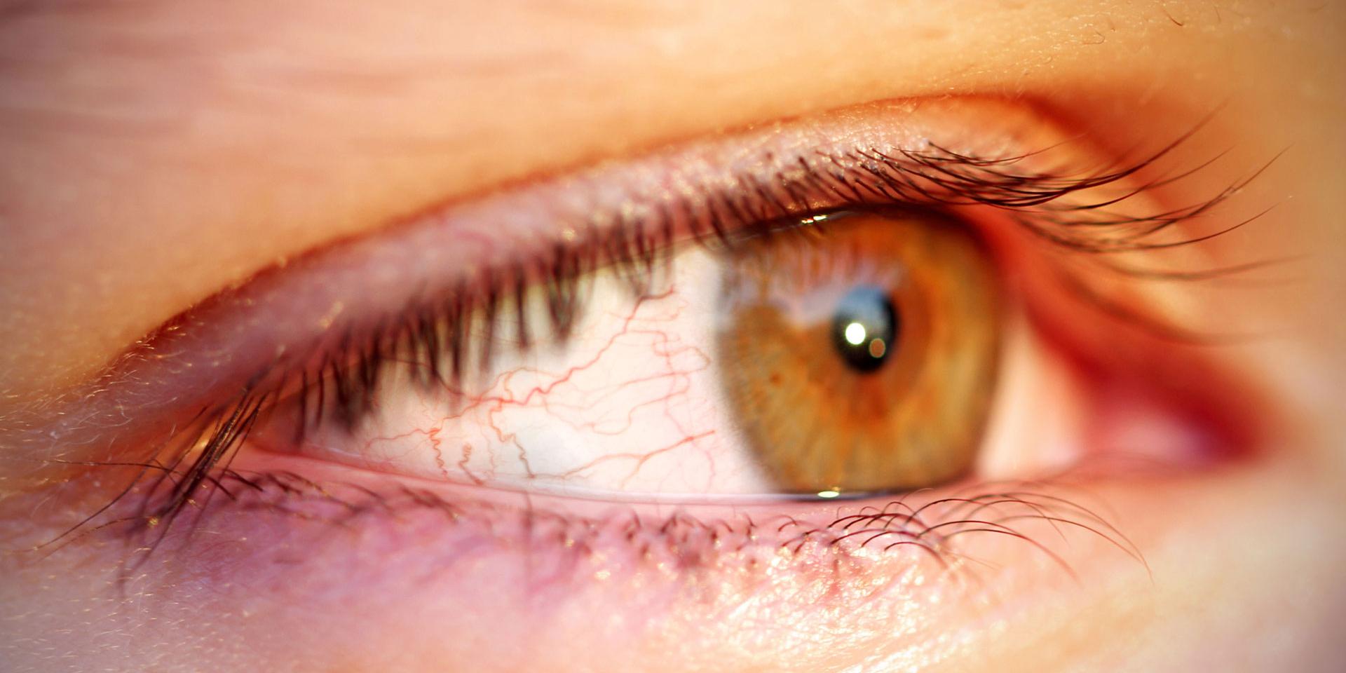 Svullna ögon, mörka ringar, röda och svidande ögon