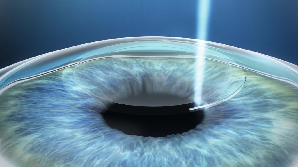 Suddig syn –hantera ögonproblem som påverkar vardagen.